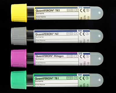 TB Testing The Differences Between QuantiFERON Gold,, 50% OFF