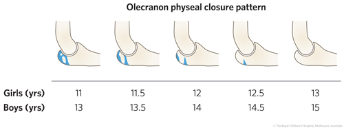 Clinical Practice Guidelines : Olecranon fracture - Emergency Department
