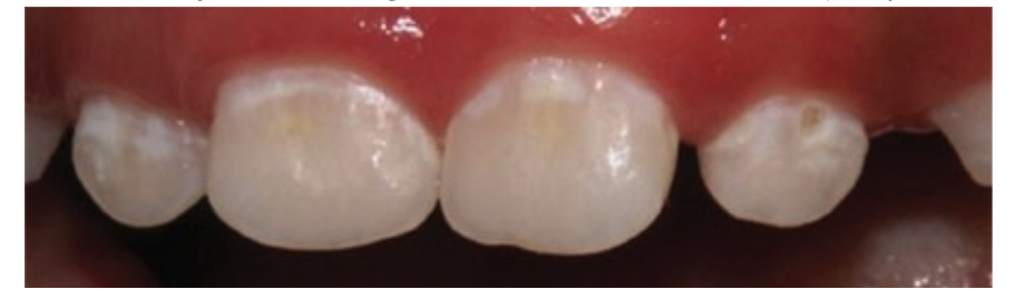 Clinical Practice Guidelines : Dental conditions - non traumatic