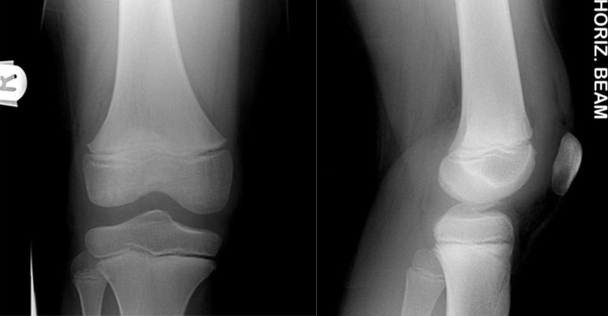 Clinical Practice Guidelines : Acute Knee Injuries - Emergency Department