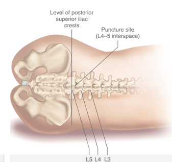 Clinical Practice Guidelines : Lumbar puncture