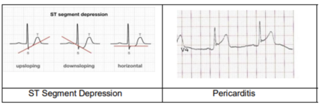 Clinical Practice Guidelines : Basic Paediatric ECG interpretation
