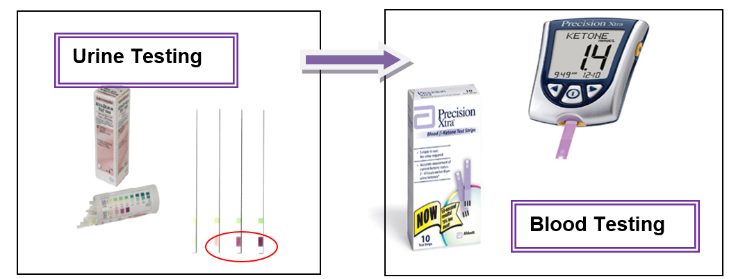 Diabetes at the RCH : Type 1 diabetes