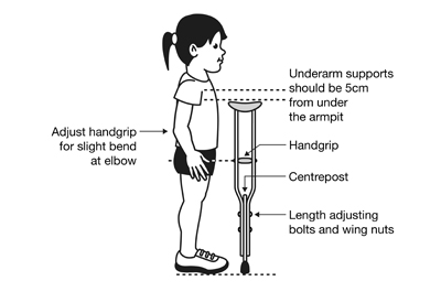 Kids Health Info : Crutches