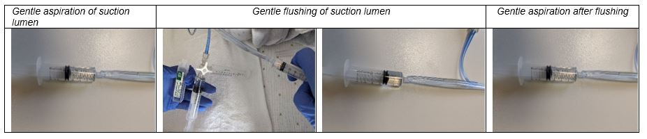 Nursing guidelines : Replogle tube management