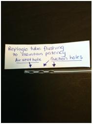 Clinical Guidelines (Nursing) : Replogle tube management