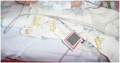 Clinical Guidelines (Nursing) : Replogle tube management