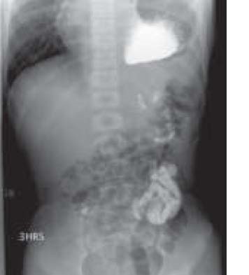 Trauma Service : Chest injury